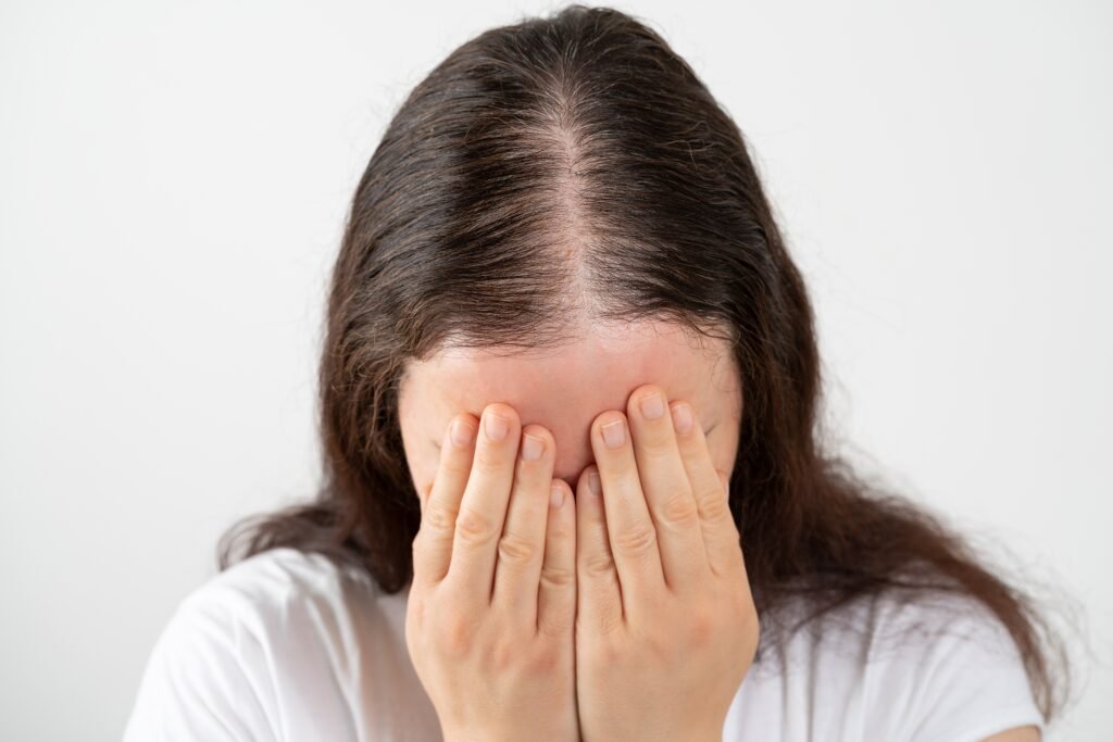 Entendiendo la Caída del Cabello: Etapas y Medición | Skingroup CDMX Coapa